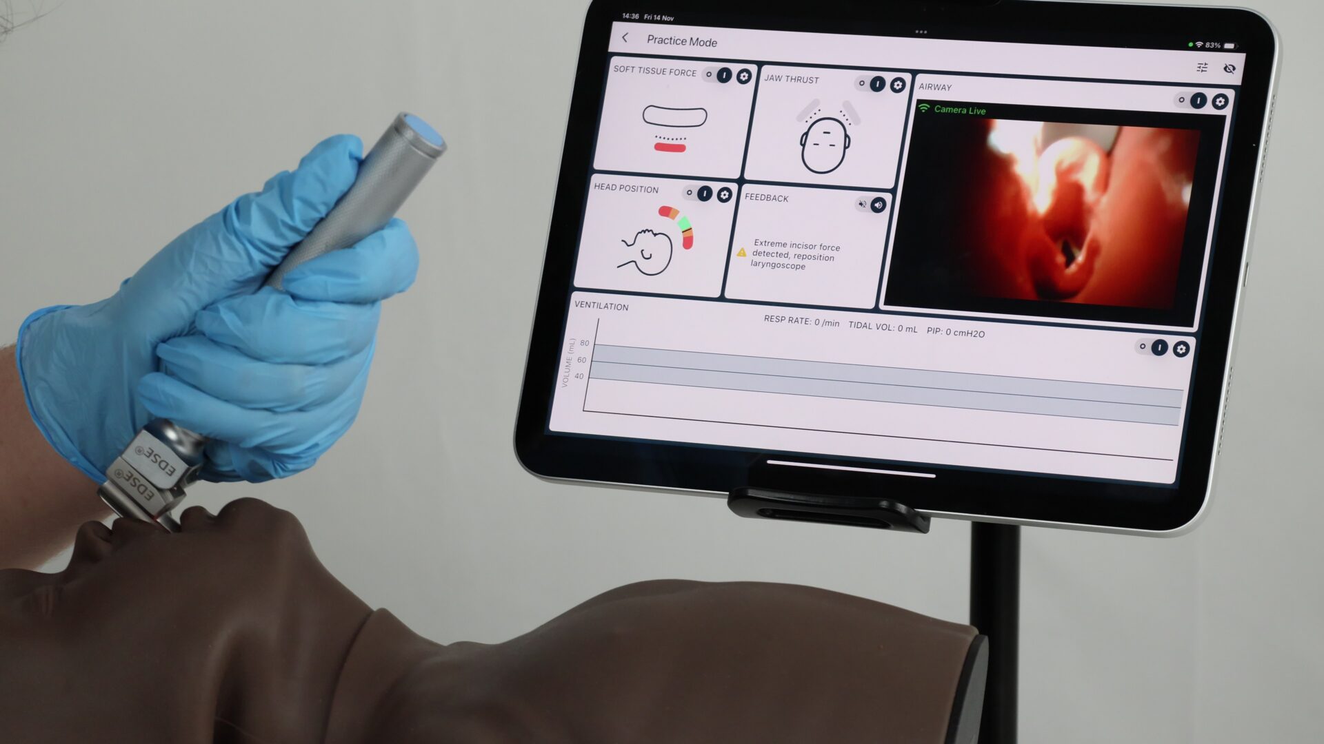 Smart Airway Baby | Pediatric Airway | Waldemar Larsson