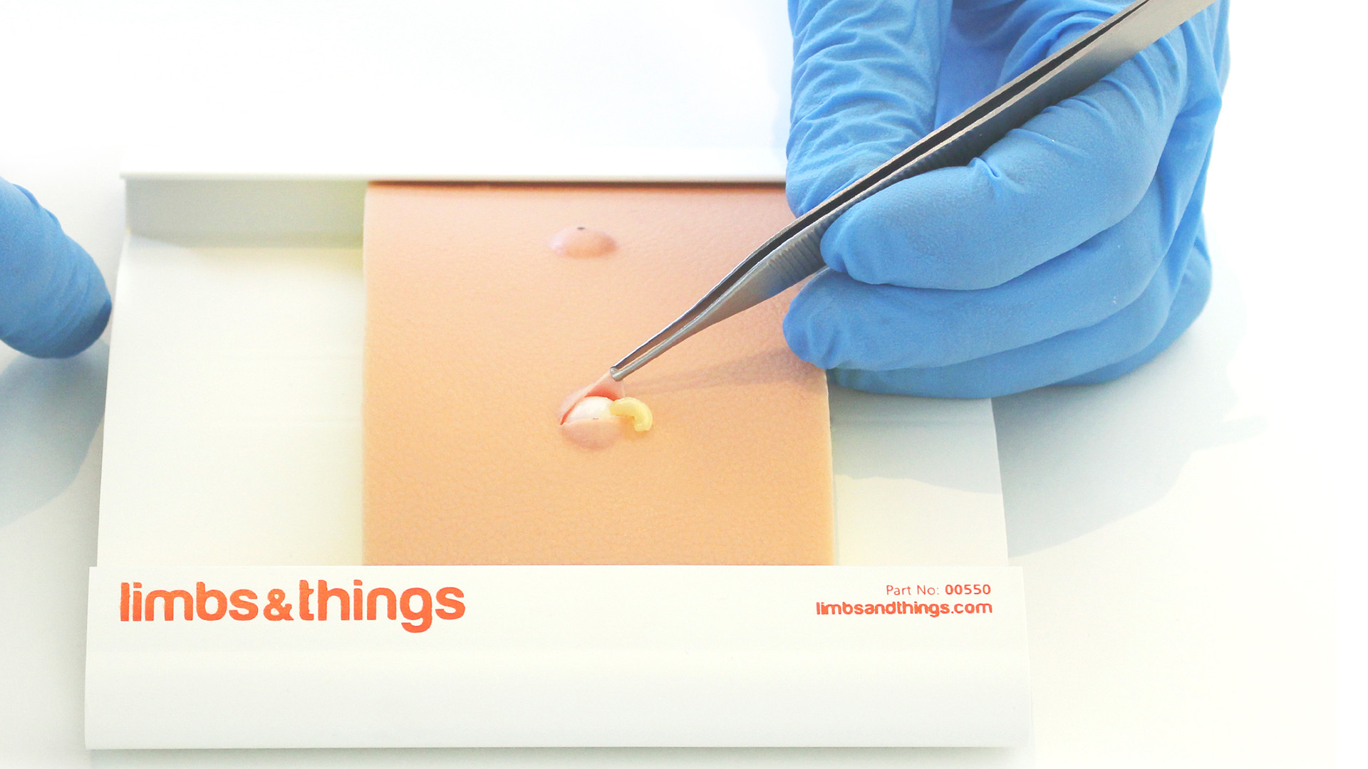 Sebaceous Cyst Pad | Waldemar Larsson