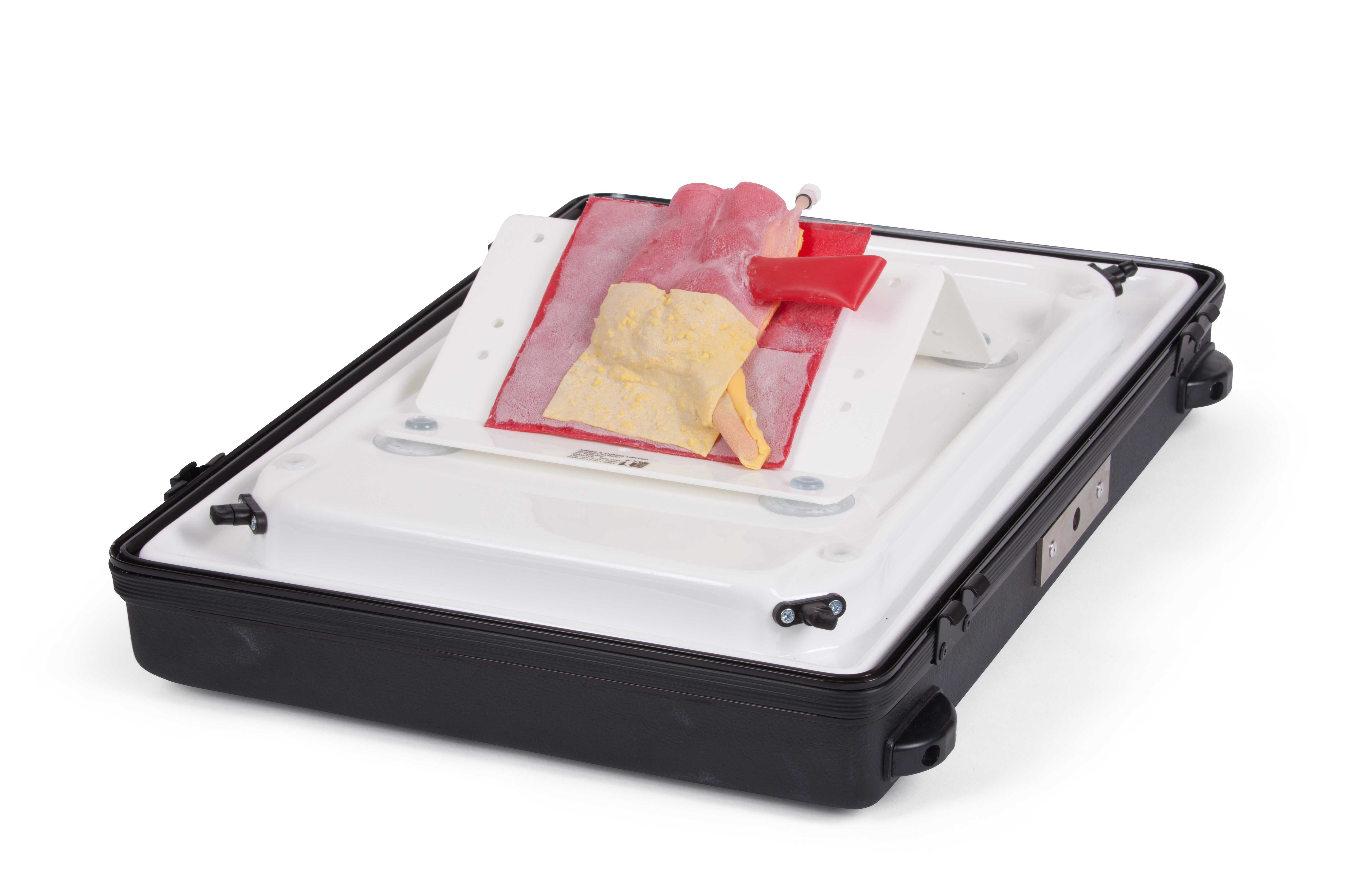 Vermiform Appendix - Normal Anatomy | Waldemar Larsson