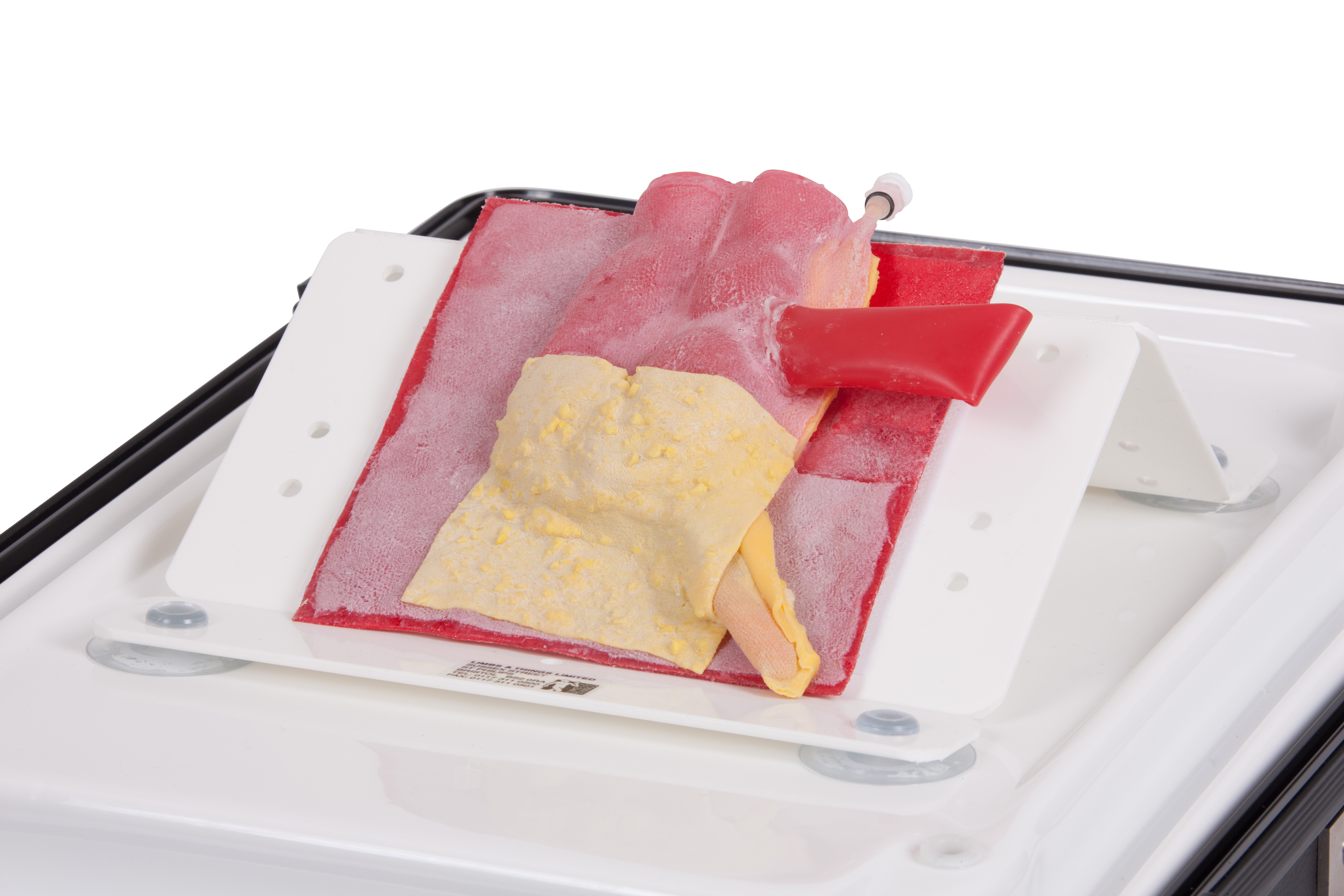 Vermiform Appendix - Normal Anatomy | Waldemar Larsson